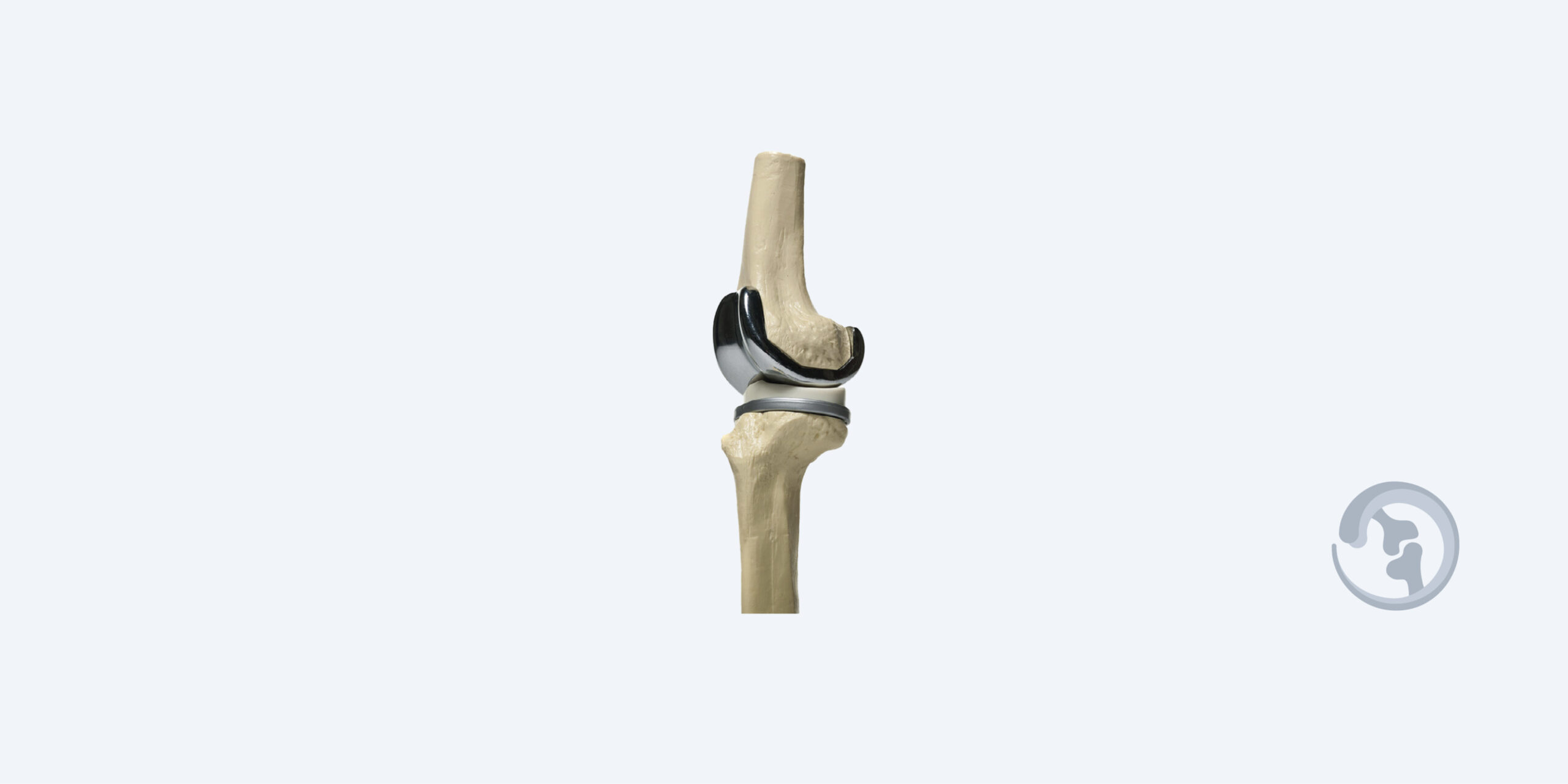Knee Replacement Surgery - Dr. Héctor González Knee Replacement Surgery - Dr. Héctor González